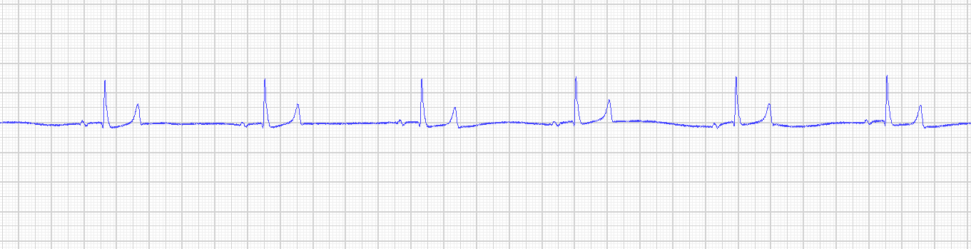 Nelson Investigates: Heart Rate | Equine Science Center